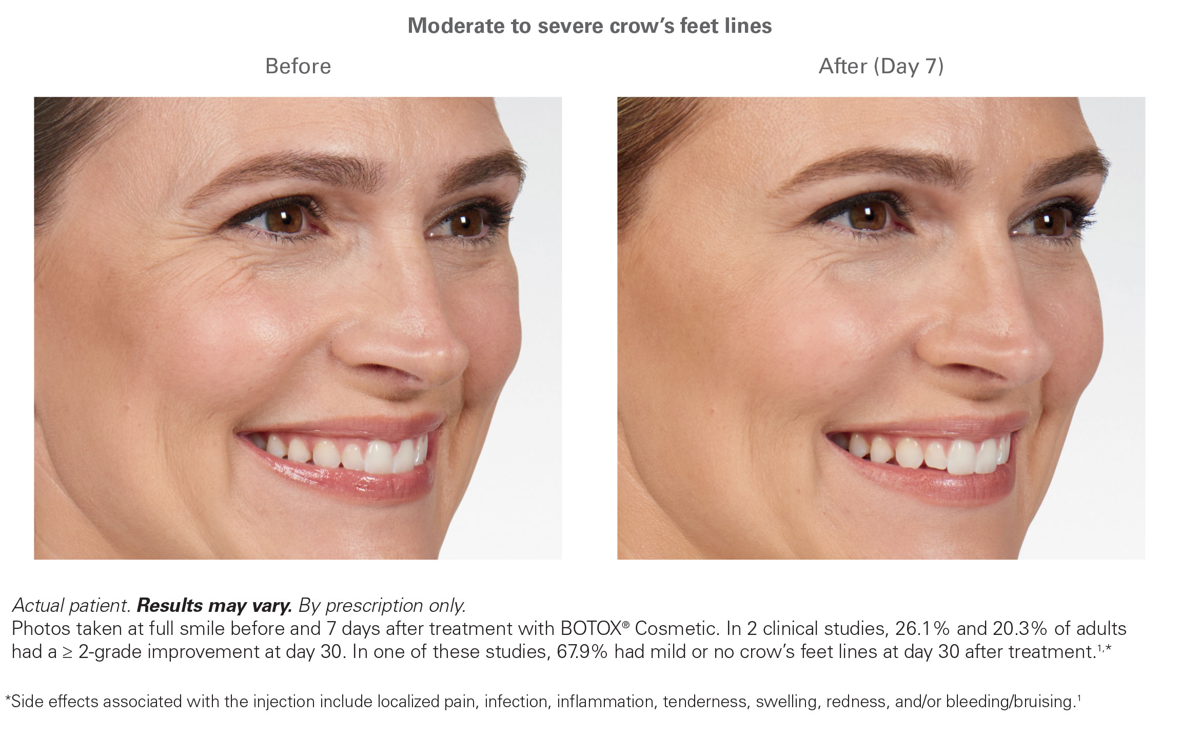 Before & After Galleries - Wink Medical Aesthetics Wink Medical Aesthetics