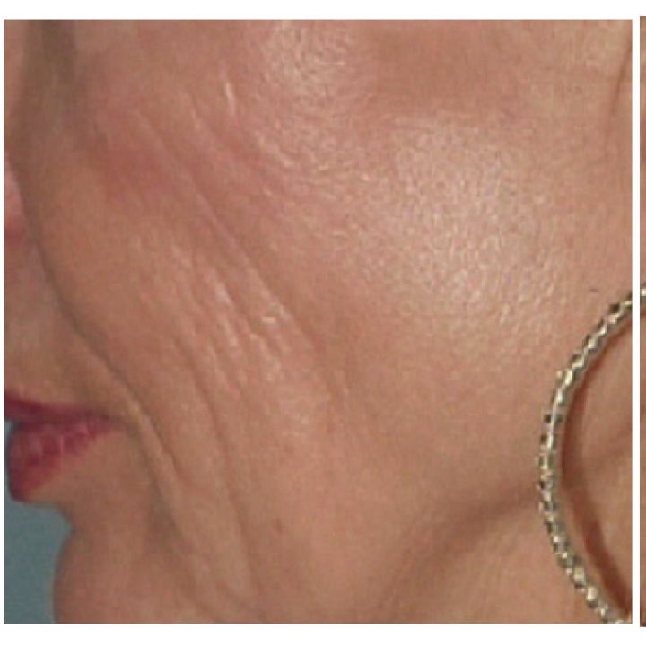 Questions and Answers - Wink Medical Aesthetics Wink Medical Aesthetics